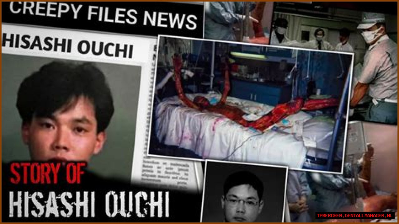Hisashi Ouchi Body Photos: The Tragic Story Behind The Images